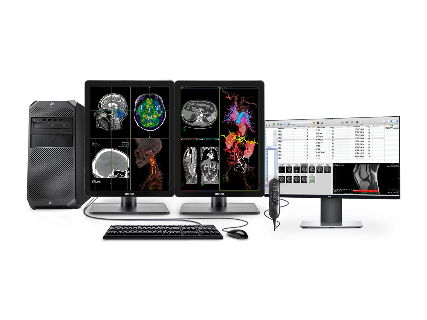 How to Choose the Right Diagnostic Display and PACS Workstation?