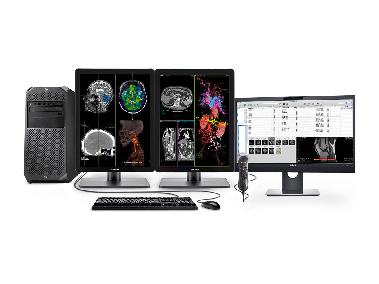 Diagnostic Displays and PACS Workstation Marketplace - Monitors.com