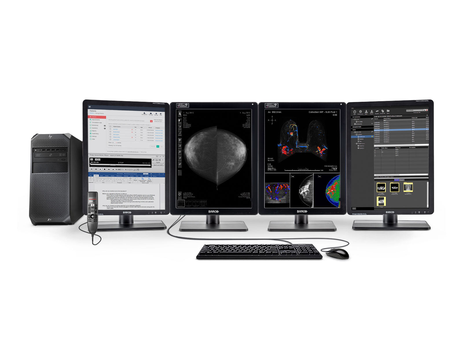 Complete Mammography Reading Station | Barco Displays, HP Workstation