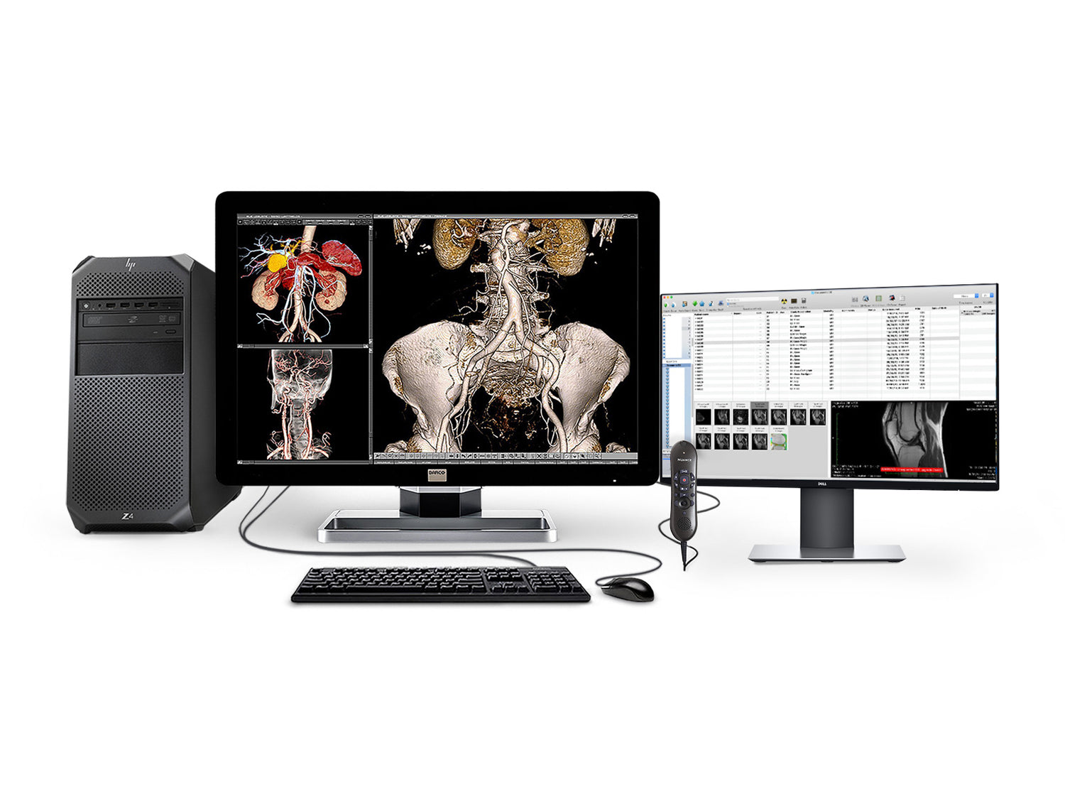 Eizo RadiForce RX440 4MP 30" Color LED Radiology PACS Display