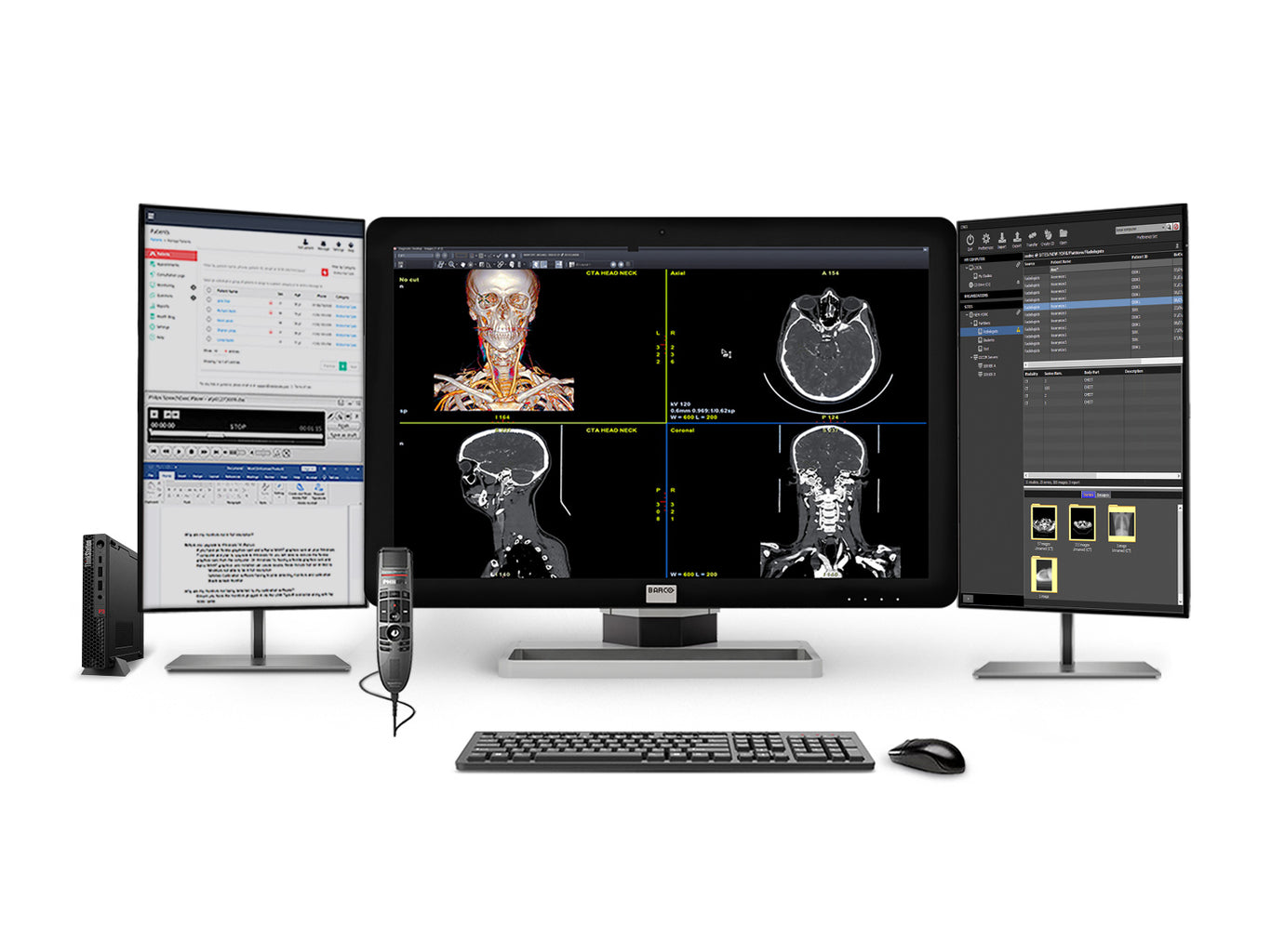 Barco Coronis Fusion MDCC-6430 6MP 30″ Radiology PACS Display + Lenovo
