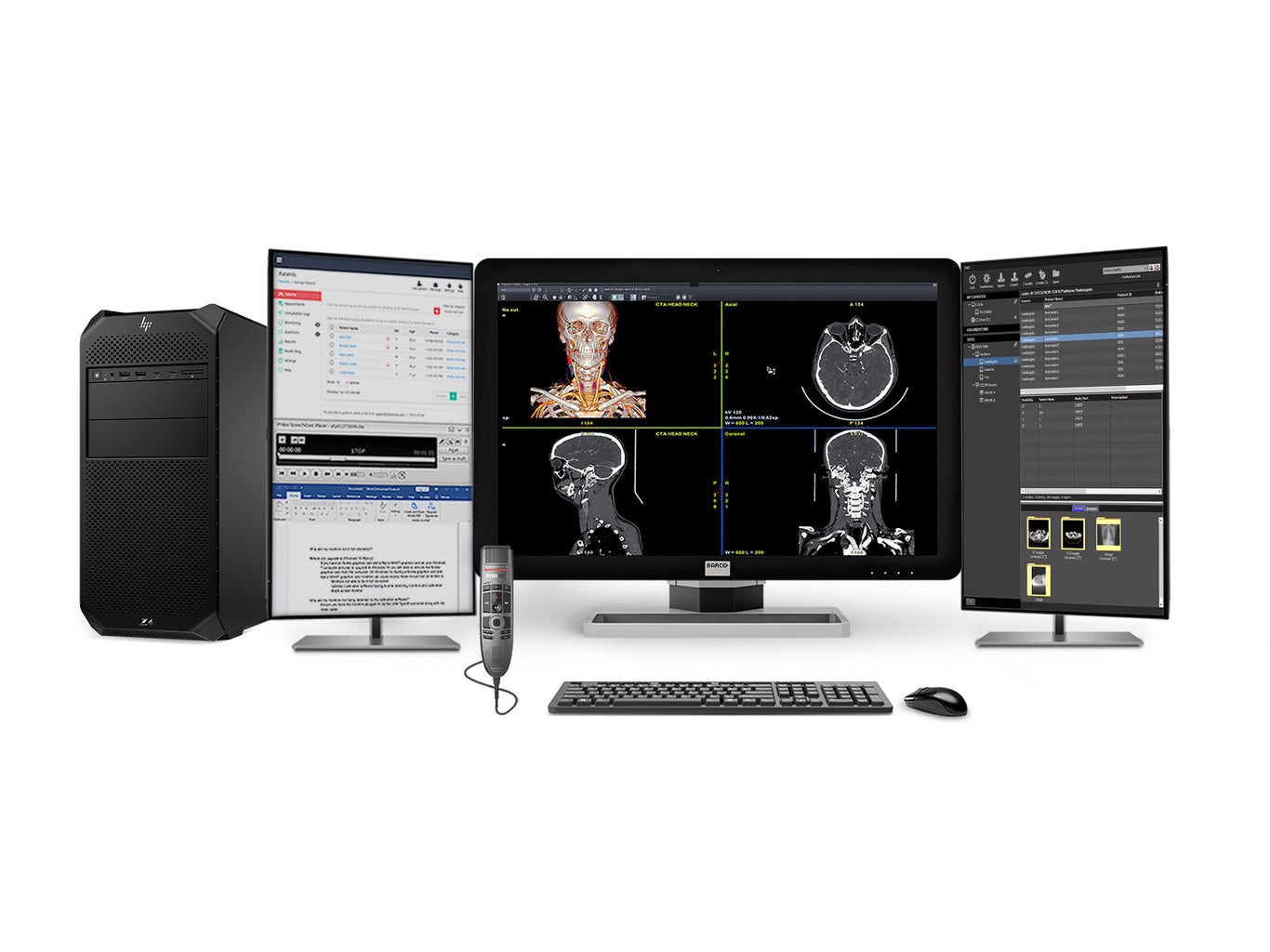 Complete PACS General Radiology Station: Barco & HP Bundle