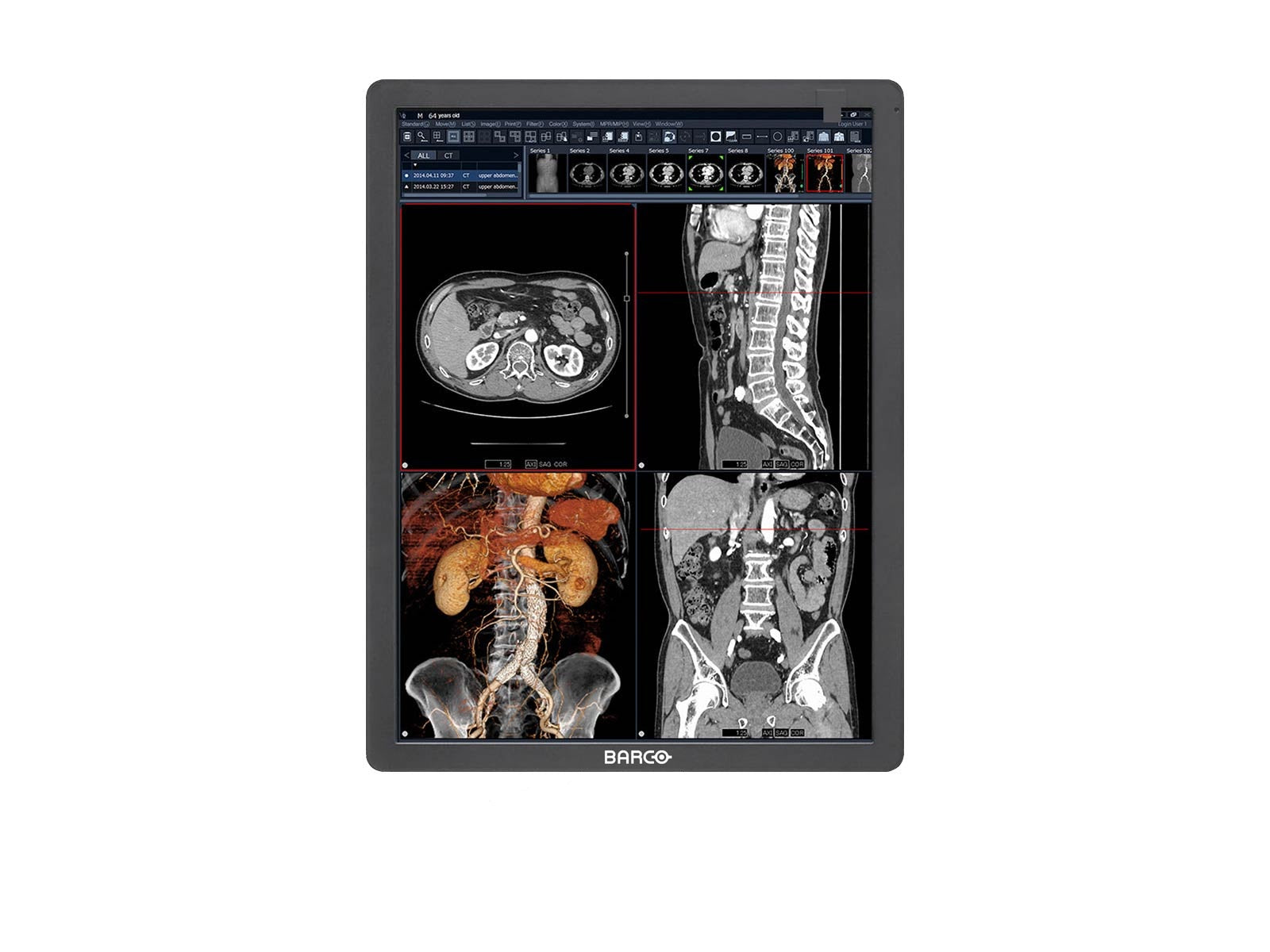 Barco Eonis MDRC-2321 21" Clinical Display Review