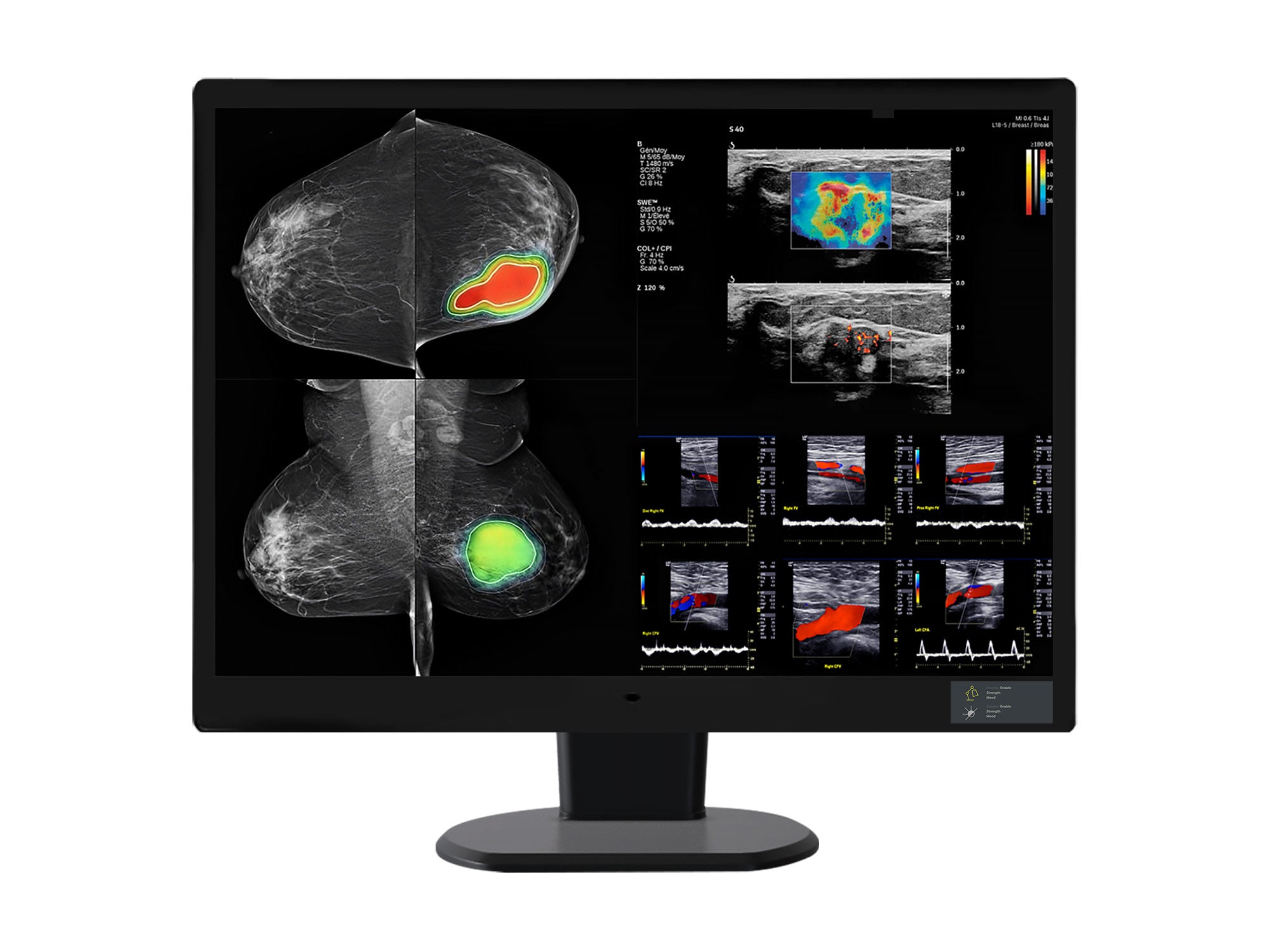 WIDE CW120N 31" 12MP Mammo 3D Display for Diagnostics