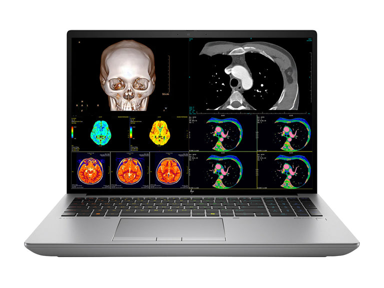 HP ZBook Fury 16 G11 Mobile Radiology Workstation | 16" OLED 9MP 4K+ U