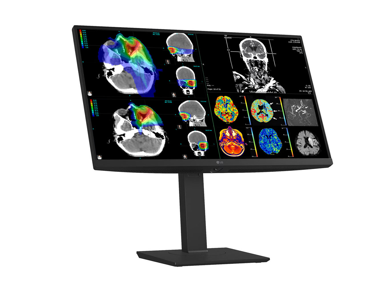 LG 27HS713C: Monitor Médico 8MP 4K para Revisión Clínica