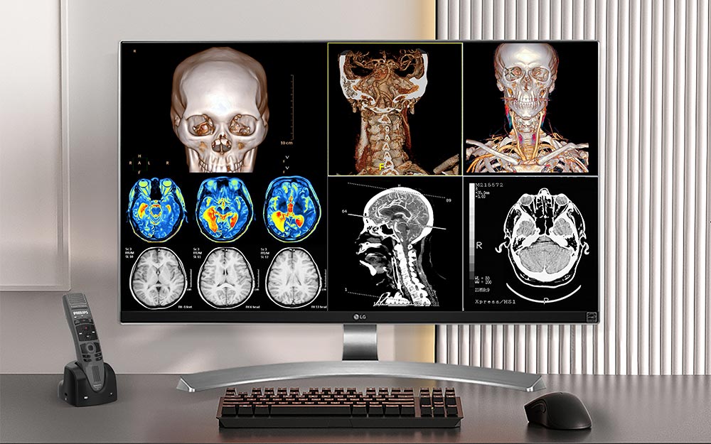 Complete PACS Gen Radiology Station | LG Display HP Mobile Workstation