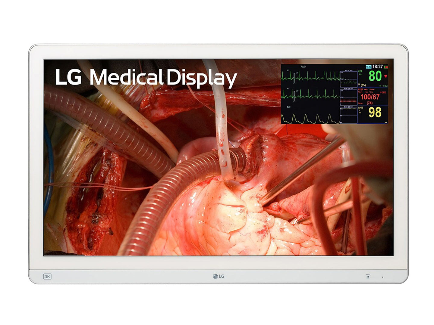 LG 27" 27HQ710S-W 4K Mini-LED 3G SDI Surgical Endoscopy Medical Displa