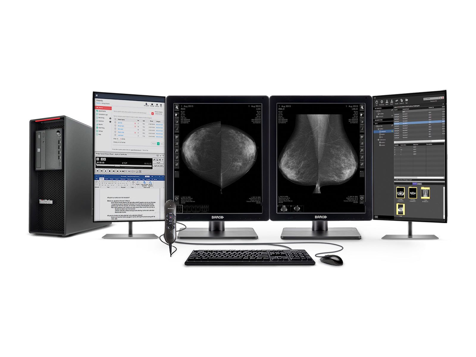 Complete Mammography Reading Station | Lenovo Workstation