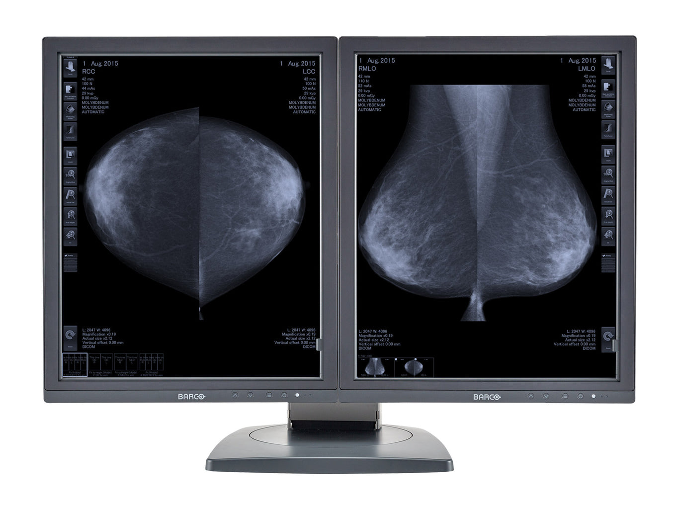 Barco MDCG-5121 5MP Grayscale Mammo 3D-DBT Display Monitor (K9601738)