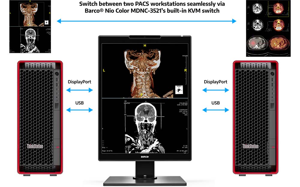 Barco Nio MDNC-3521 3MP 21" Color LED Diagnostic Display