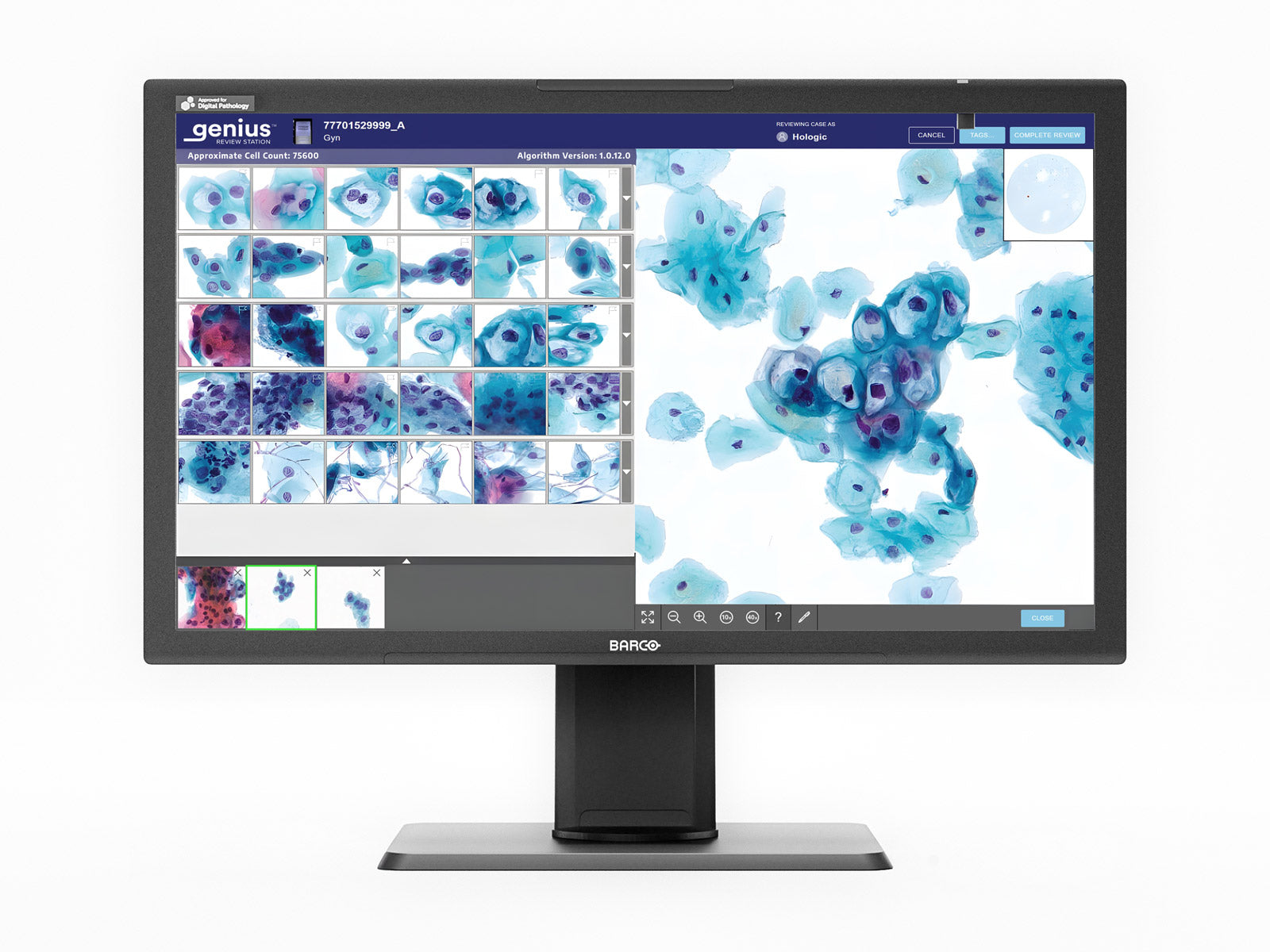Barco Hologic MDPC‐8127 HLX 8MP Écran numérique 27" MXRT-4700 K9301100AITE