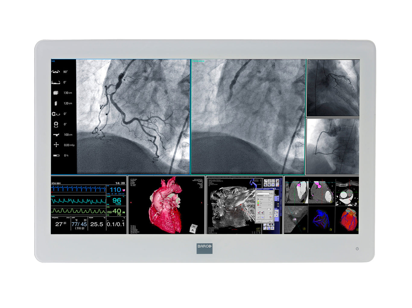 Barco MDSC-2226 MNA 2MP Full HD Surgical Monitor