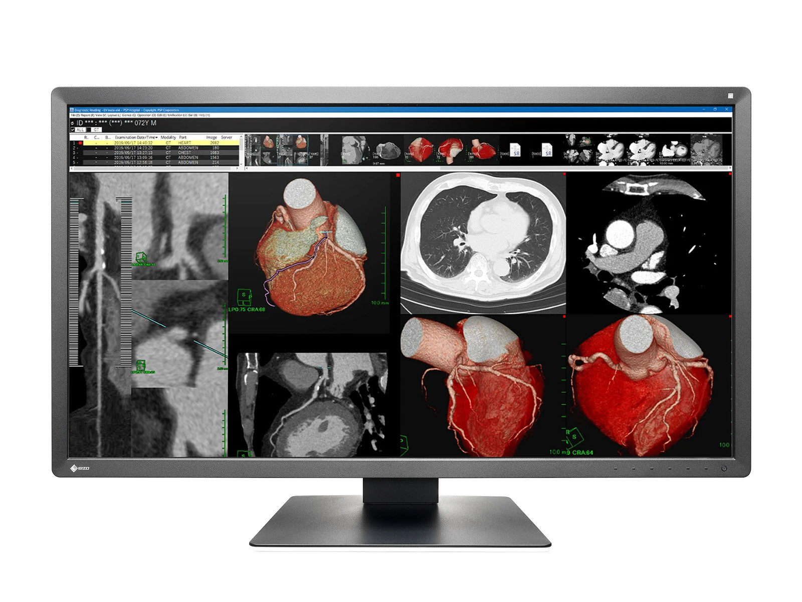 Complete PACS Gen Radiology Station | Eizo Displays | HP Workstation