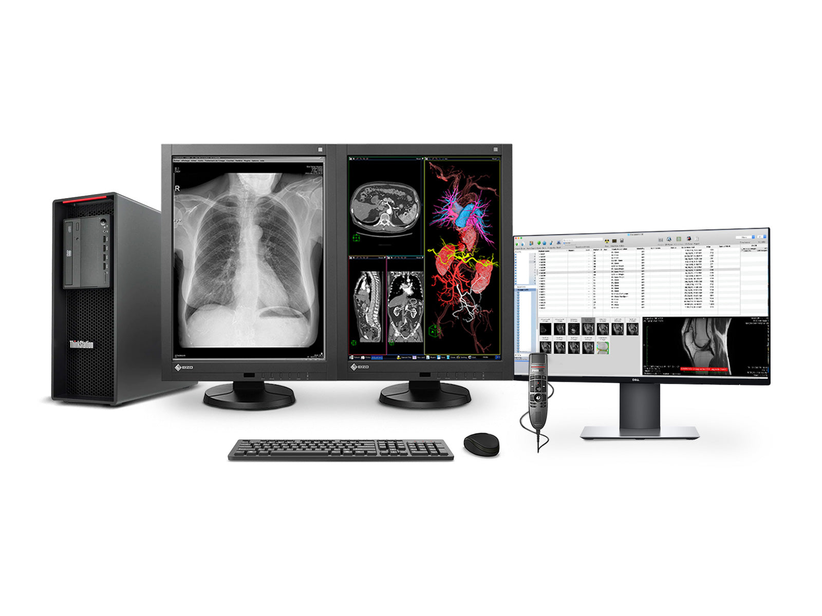 Eizo Complete PACS General Radiology Station | Lenovo Workstation
