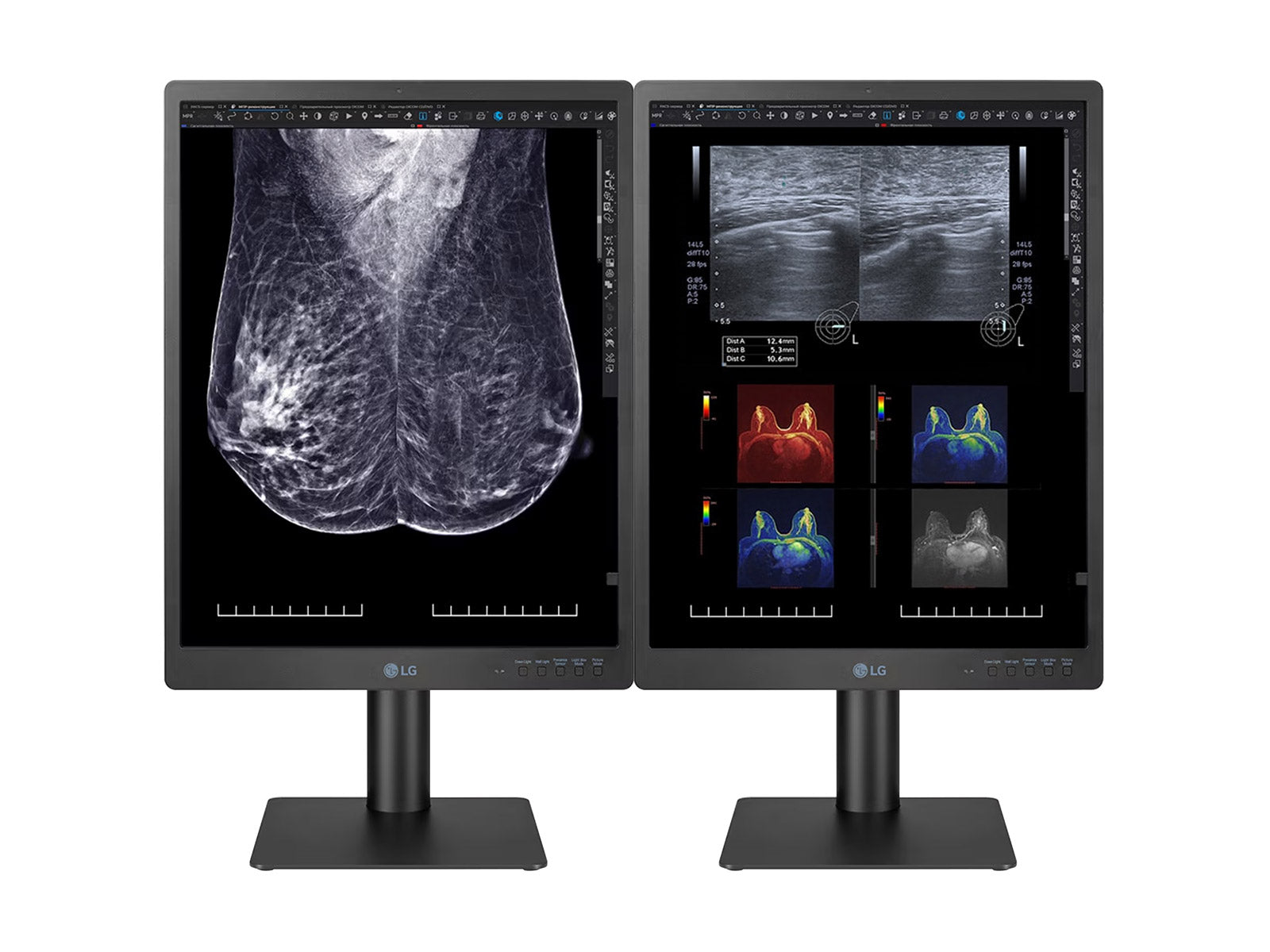 LG 21HQ613D 5MP Mammography Display Monitor Overview