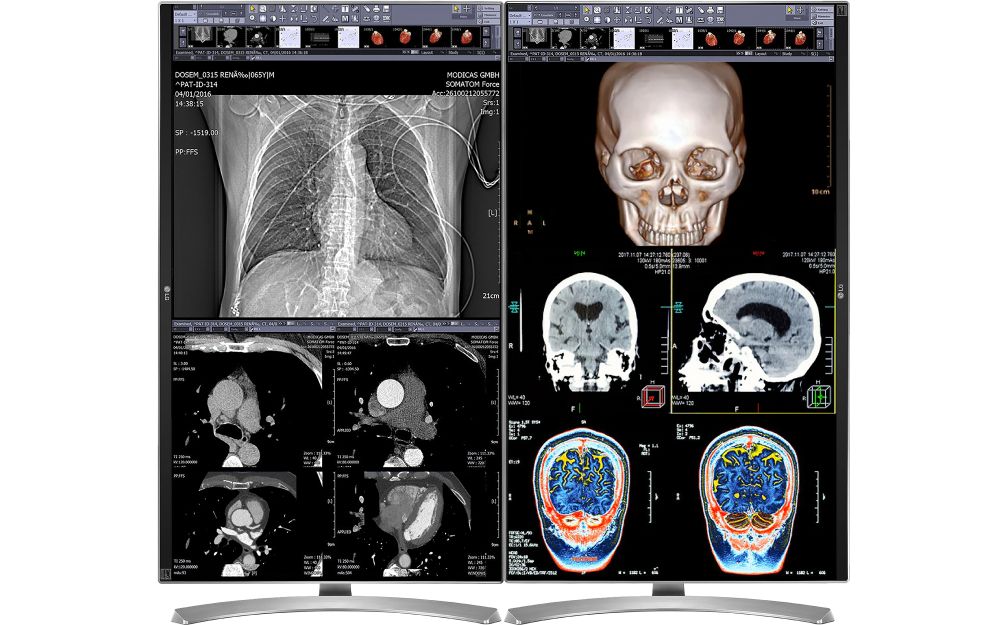 Complete PACS Gen Radiology Station | LG Display HP Mobile Workstation