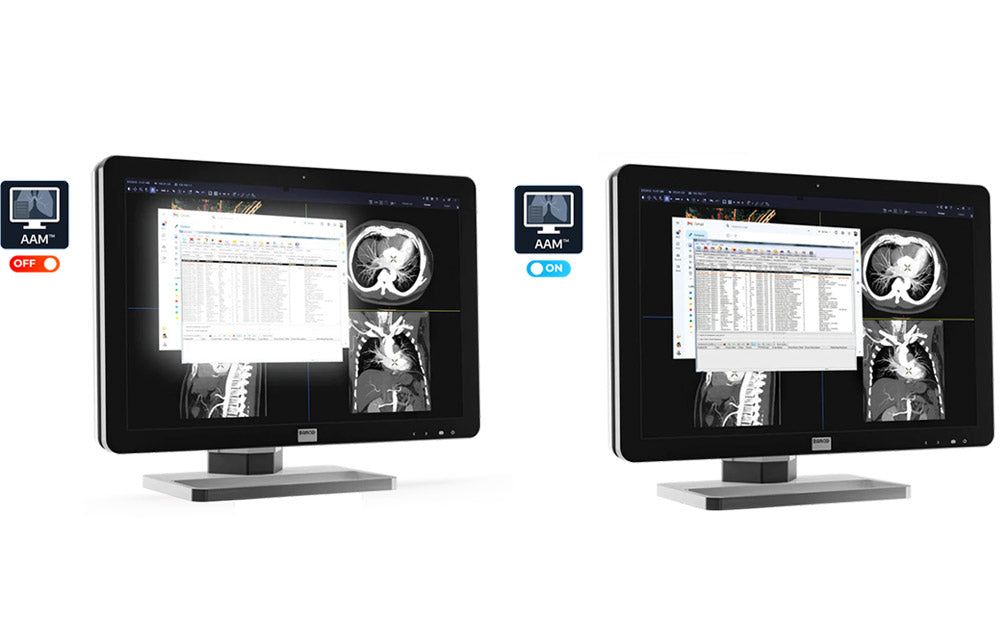 Barco® Coronis Fusion MDCC-6230 6MP Color LED PACS Display (K9601450)