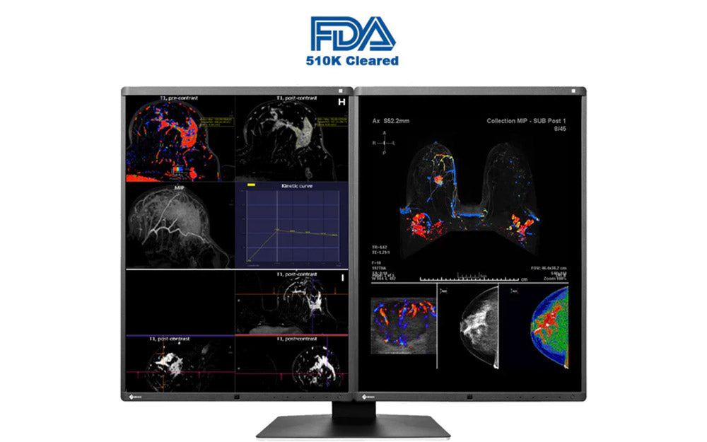 Eizo RadiForce RX560 5MP Color LED 3D-DBT Mammo Display (RX560-BK)