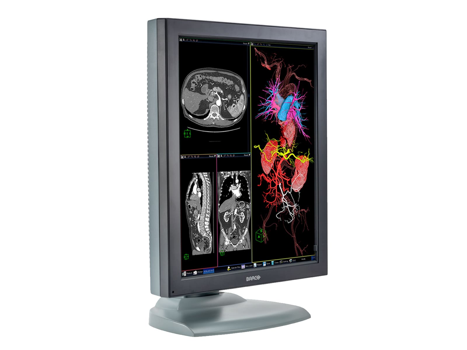 Barco® Nio MDNC-3121 HB 3MP Color Diagnostic Monitor (K9603023)