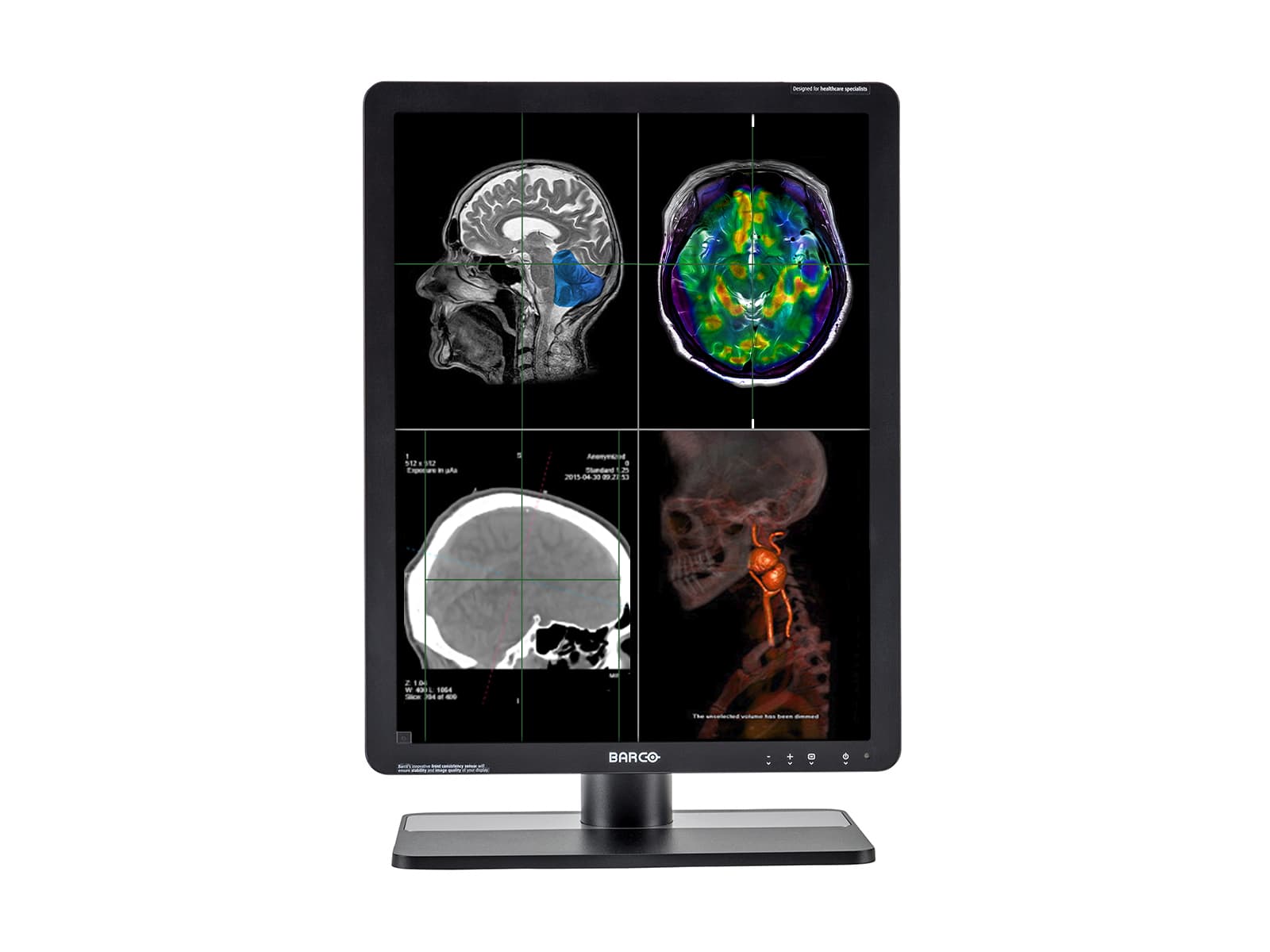 Barco® Eonis MDRC-2221 2MP Color LED Radiology Display (K9301880A)