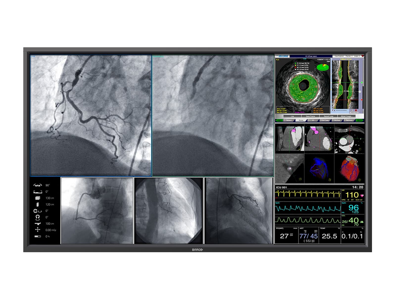 Barco Steris MDSC-8258 RLG 58" 8MP Surgical Display